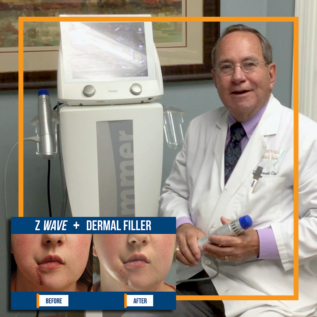 Dr. Clemons of Renovus Medical Spa Softens and Repairs Thick, Fibrotic ...